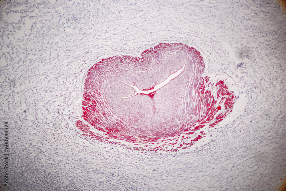 Histological Uterus human, Uterine tube human, Placenta human and ...