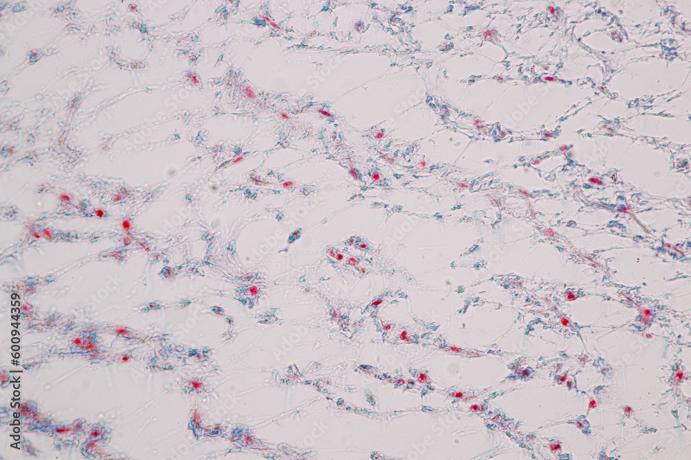 Histological Uterus human, Uterine tube human, Placenta human and ...