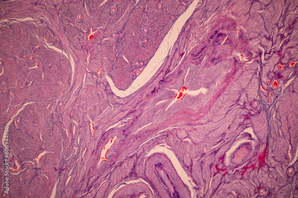 Histological Uterus human, Uterine tube human, Placenta human and ...