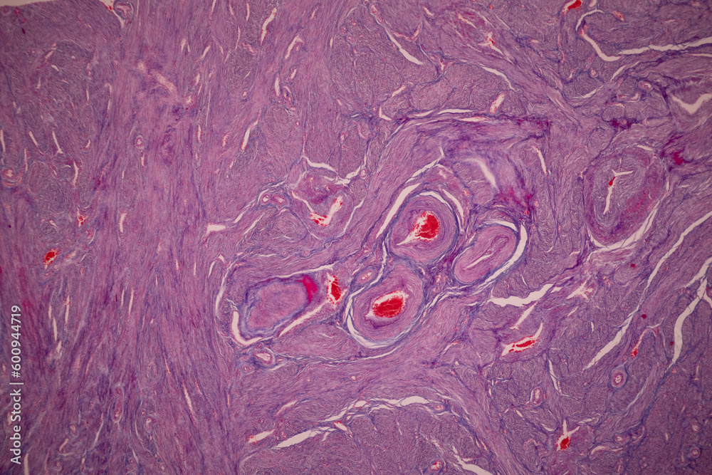 Histological Uterus human, Uterine tube human, Placenta human and ...