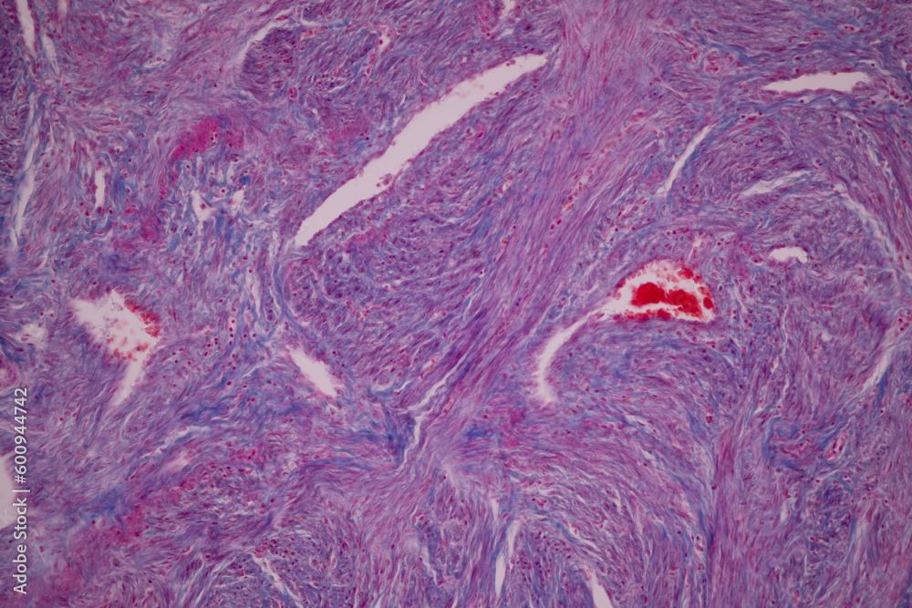 Foto de Histological Uterus human, Uterine tube human, Placenta human ...
