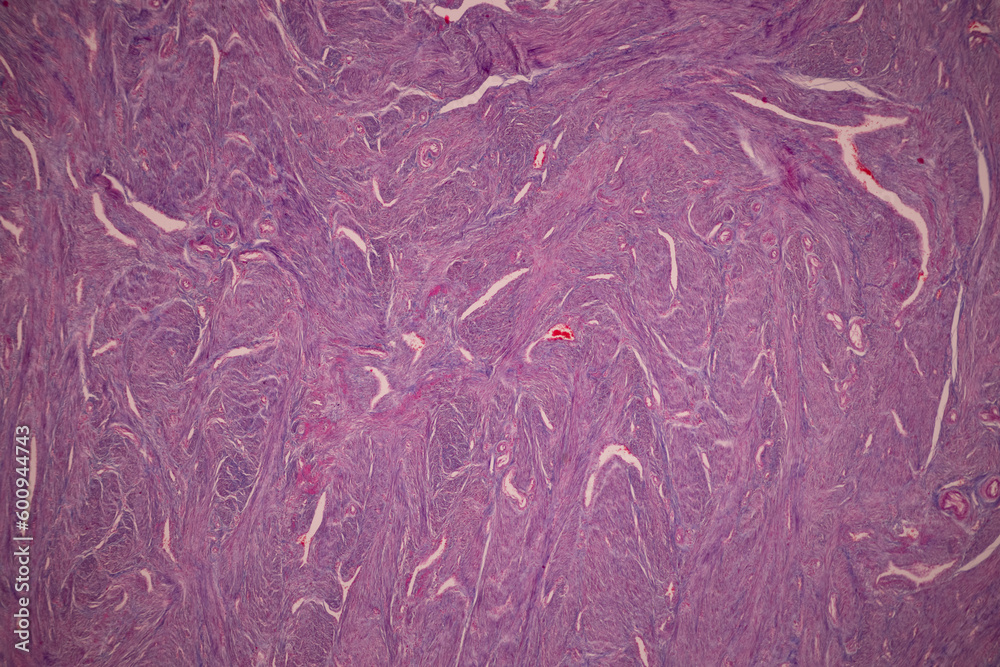 Histological Uterus human, Uterine tube human, Placenta human and ...