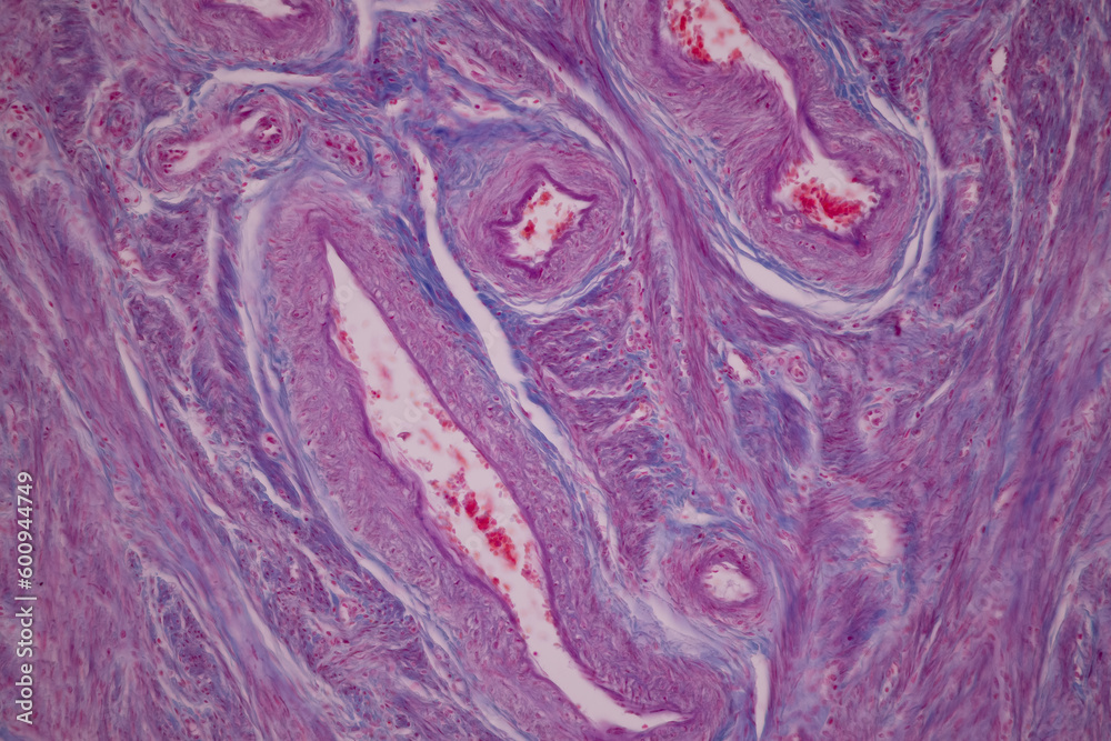 Histological Uterus human, Uterine tube human, Placenta human and ...