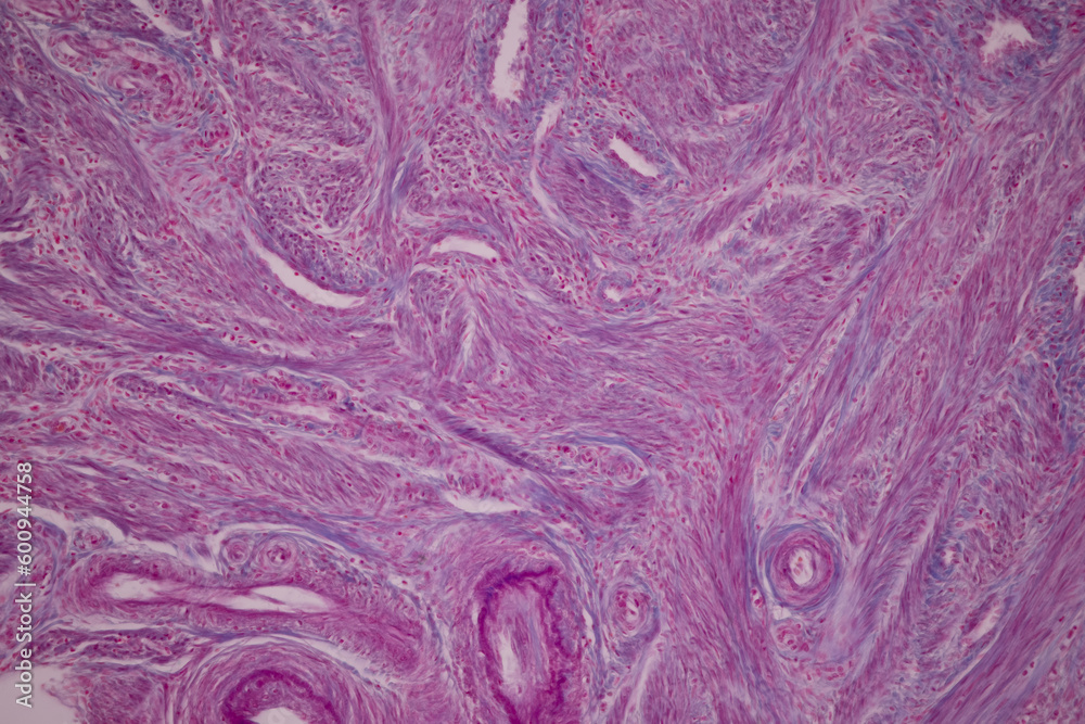 Histological Uterus human, Uterine tube human, Placenta human and ...