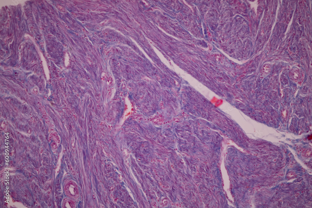 Histological Uterus human, Uterine tube human, Placenta human and ...