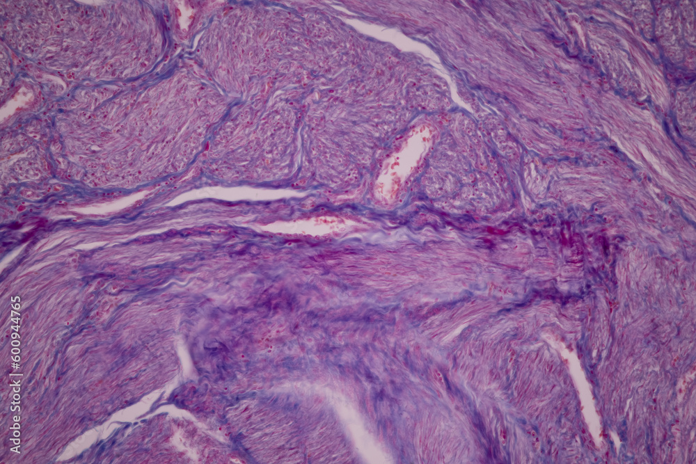 Histological Uterus human, Uterine tube human, Placenta human and ...