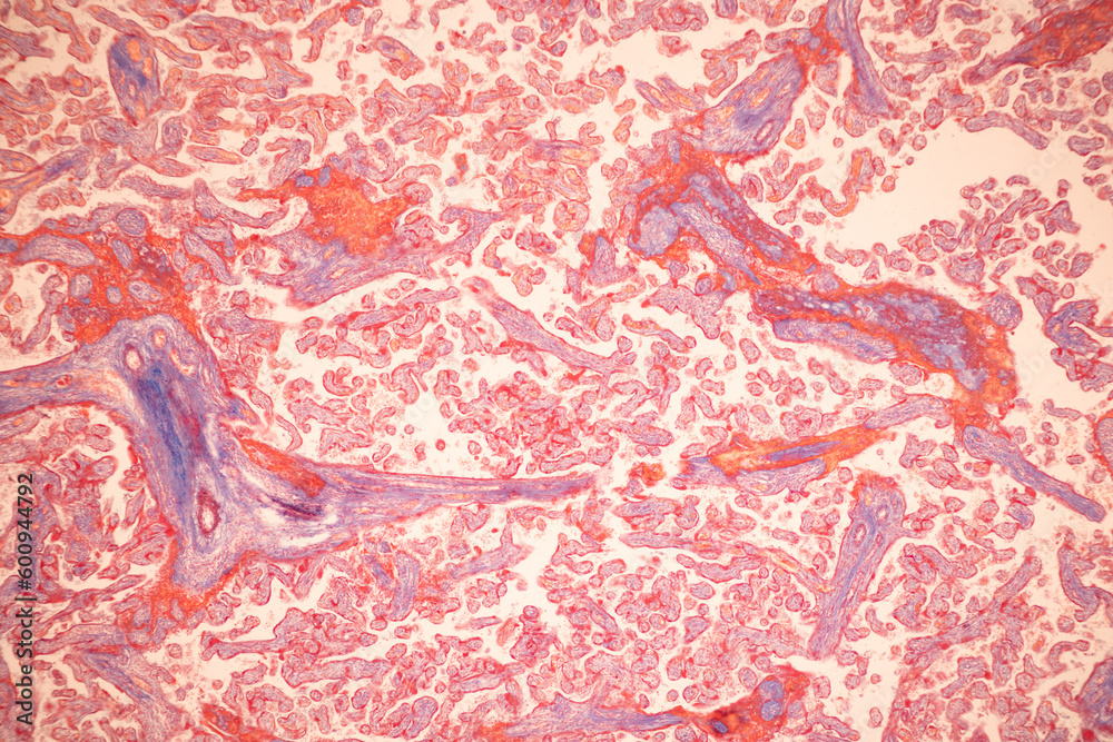 Foto de Histological Uterus human, Uterine tube human, Placenta human ...