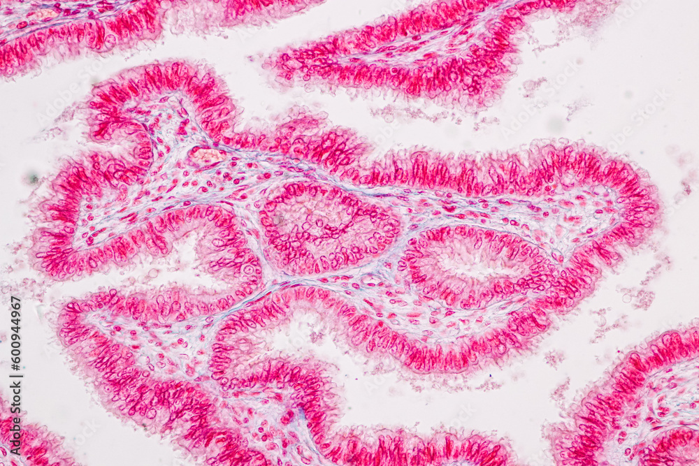 Histological Uterus human, Uterine tube human, Placenta human and ...