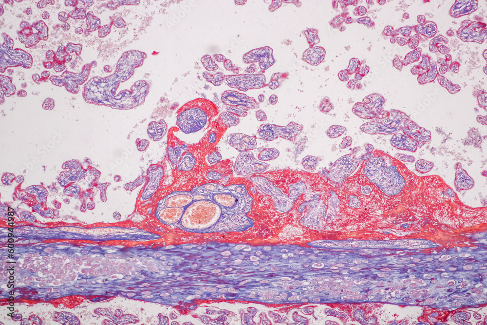 Histological Uterus human, Uterine tube human, Placenta human and ...