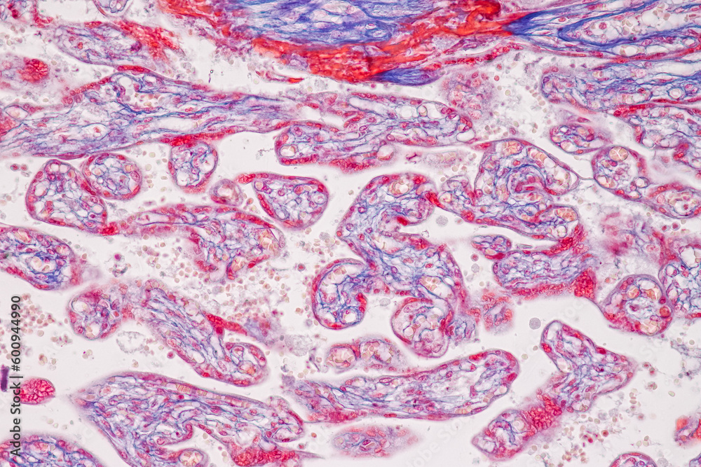 Histological Uterus human, Uterine tube human, Placenta human and ...