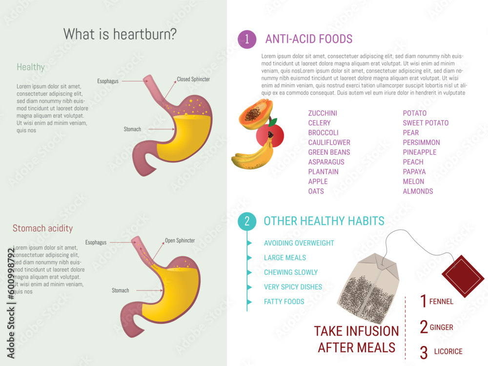 Infographic of the stomach when it is healthy and when there is ...