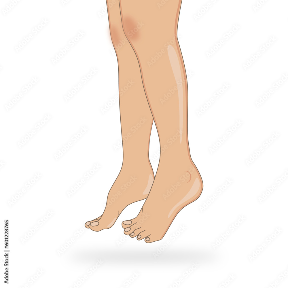 Female legs barefoot, side view. Vector illustration, hand drawn ...