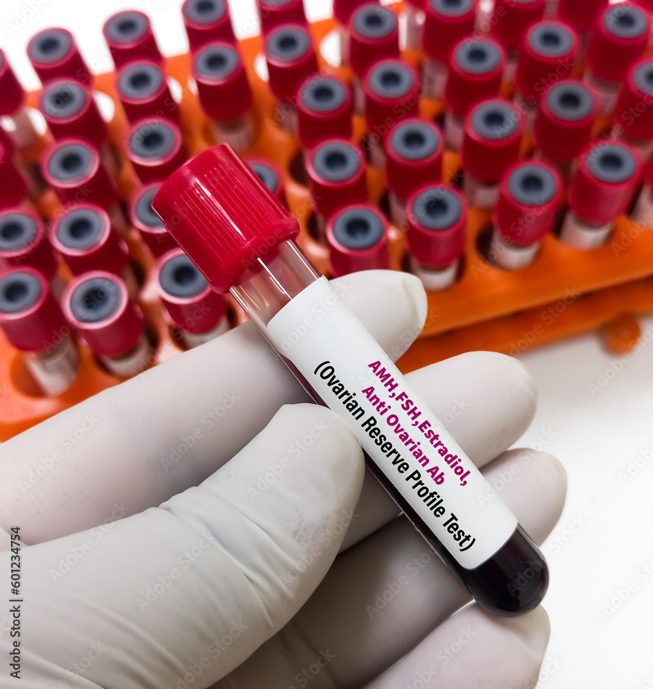 Blood sample for Ovarian Reserve Test, ORT is a test combination of FSH ...