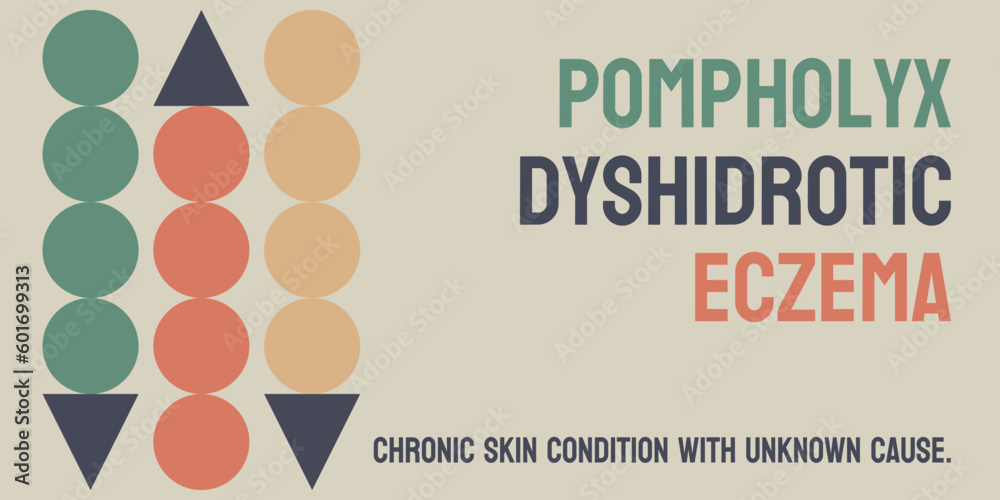 Pompholyx dyshidrotic eczema: Skin condition causing small blisters on ...