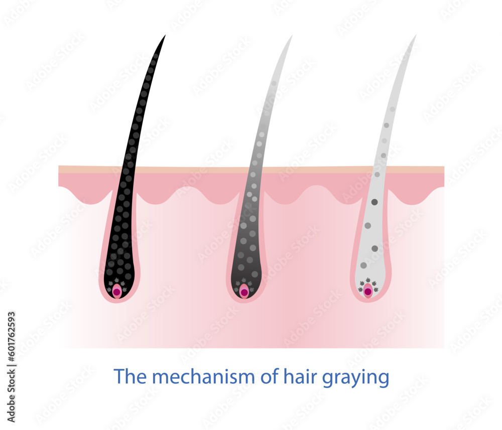 The mechanism of hair graying with scalp layer vector isolated on white ...