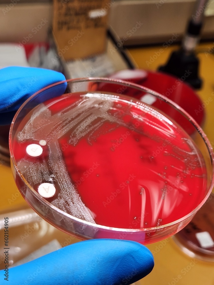 Streptococcus pneumoniae on blood agar with bacitracin and optochin ...