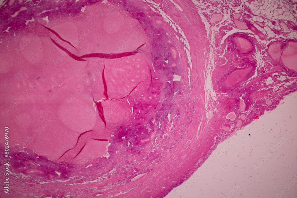 Histological Pancreas human, Liver human, Vermiform appendix human and ...