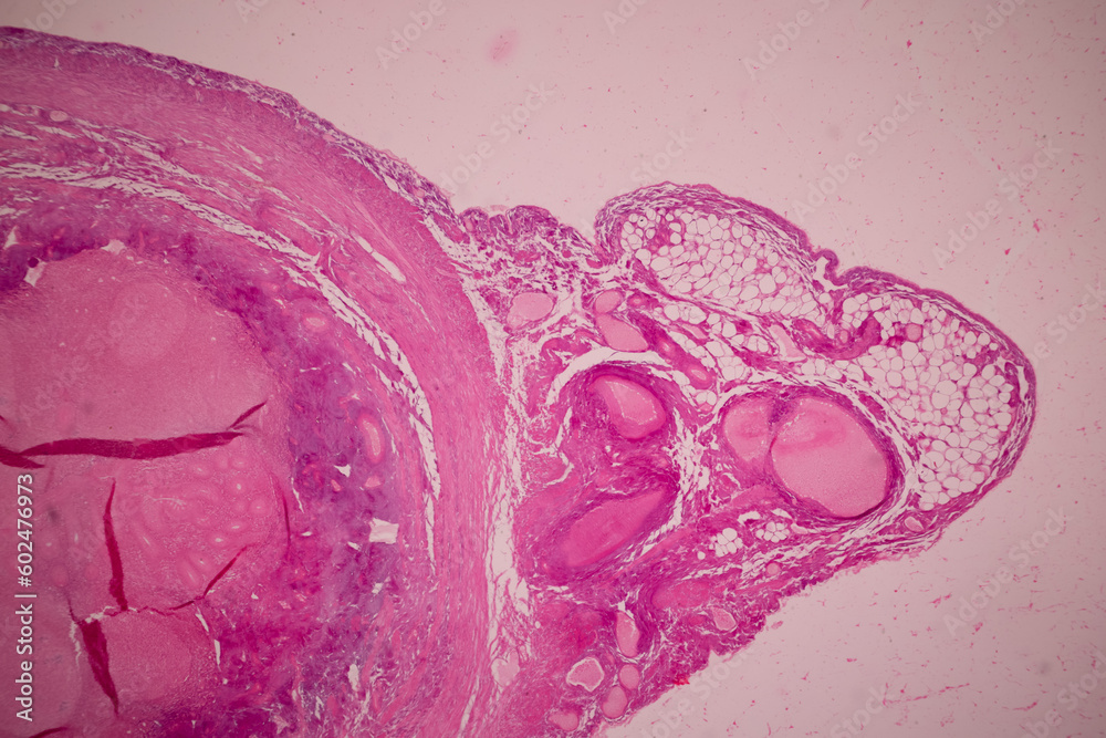 Photo & Art Print Histological Pancreas human, Liver human, Vermiform ...