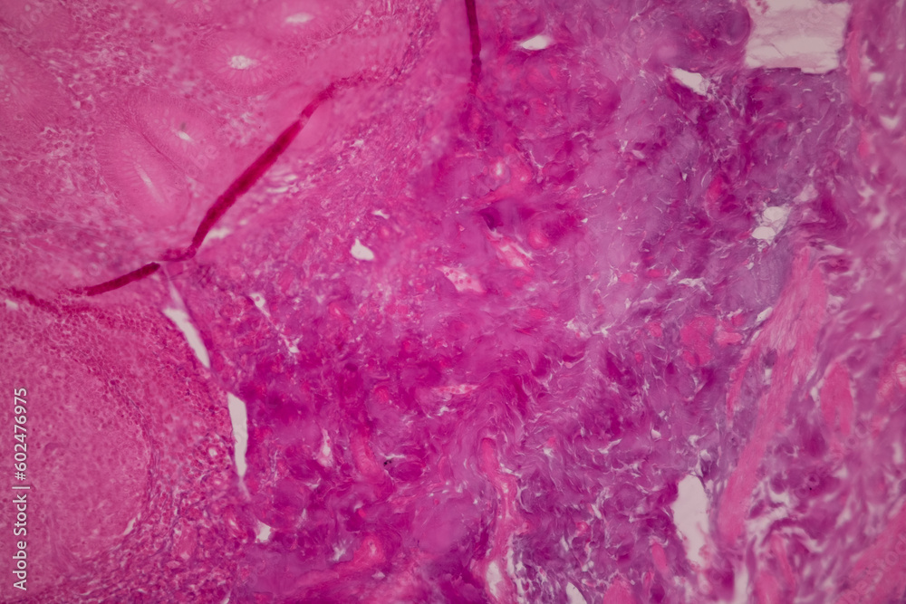 Histological Pancreas human, Liver human, Vermiform appendix human and ...