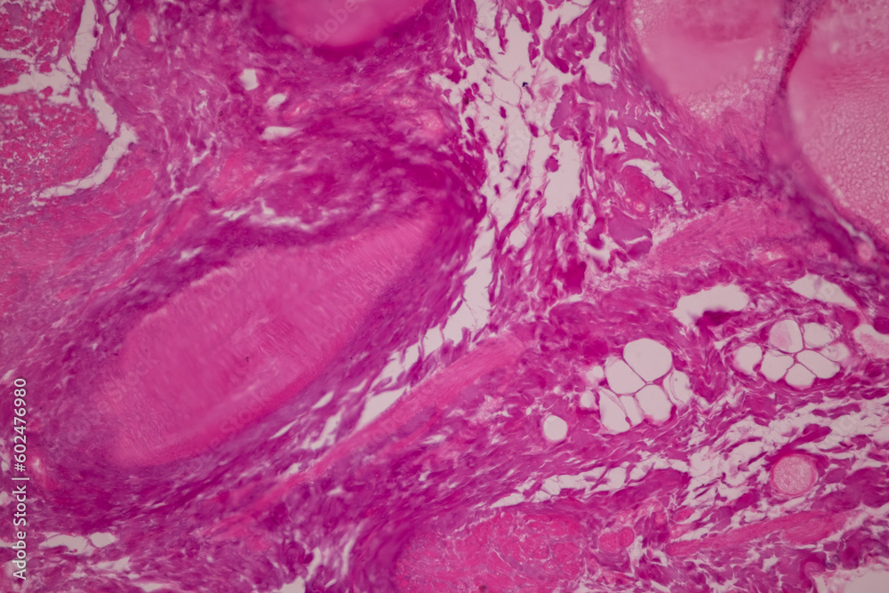 Histological Pancreas human, Liver human, Vermiform appendix human and ...