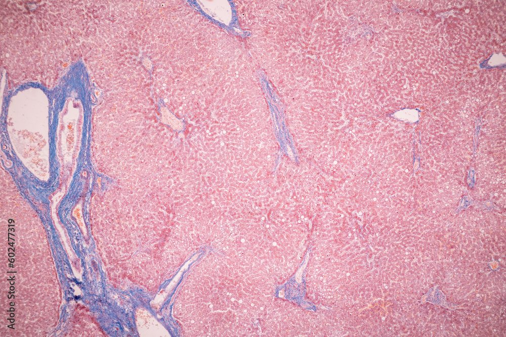 Foto de Histological Pancreas human, Liver human, Vermiform appendix ...