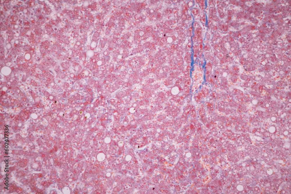 Histological Pancreas human, Liver human, Vermiform appendix human and ...