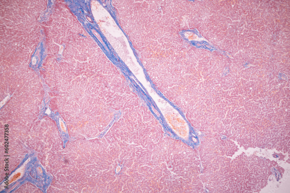 Histological Pancreas human, Liver human, Vermiform appendix human and ...