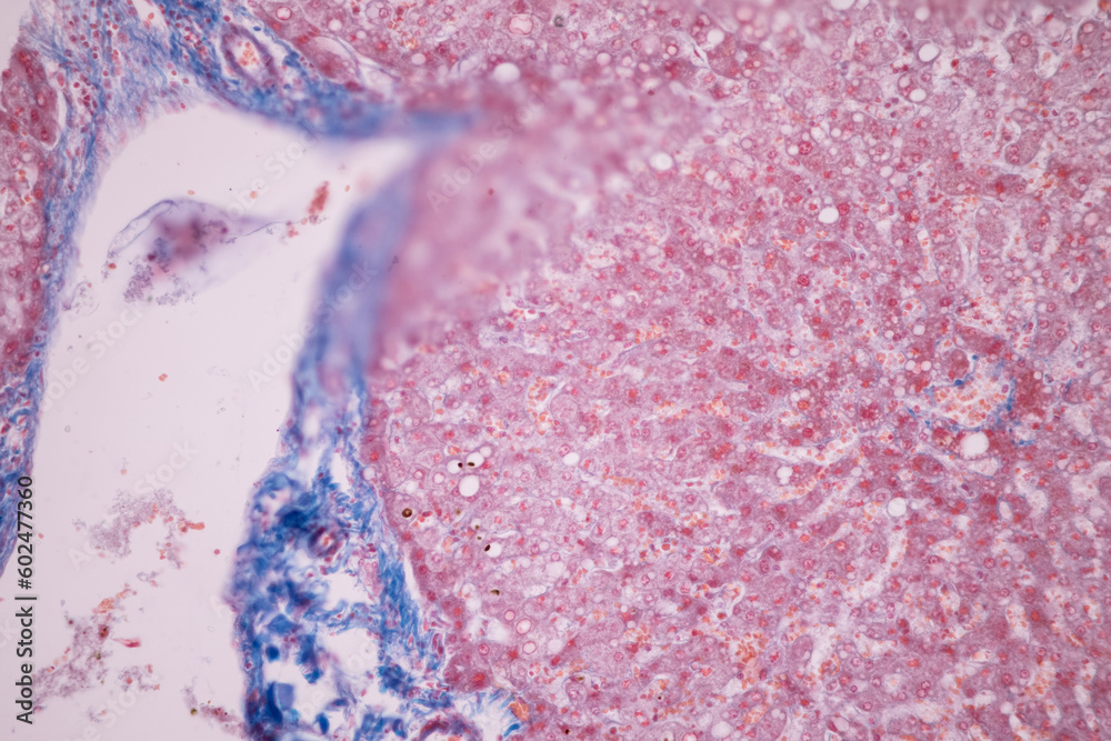 Histological Pancreas human, Liver human, Vermiform appendix human and ...