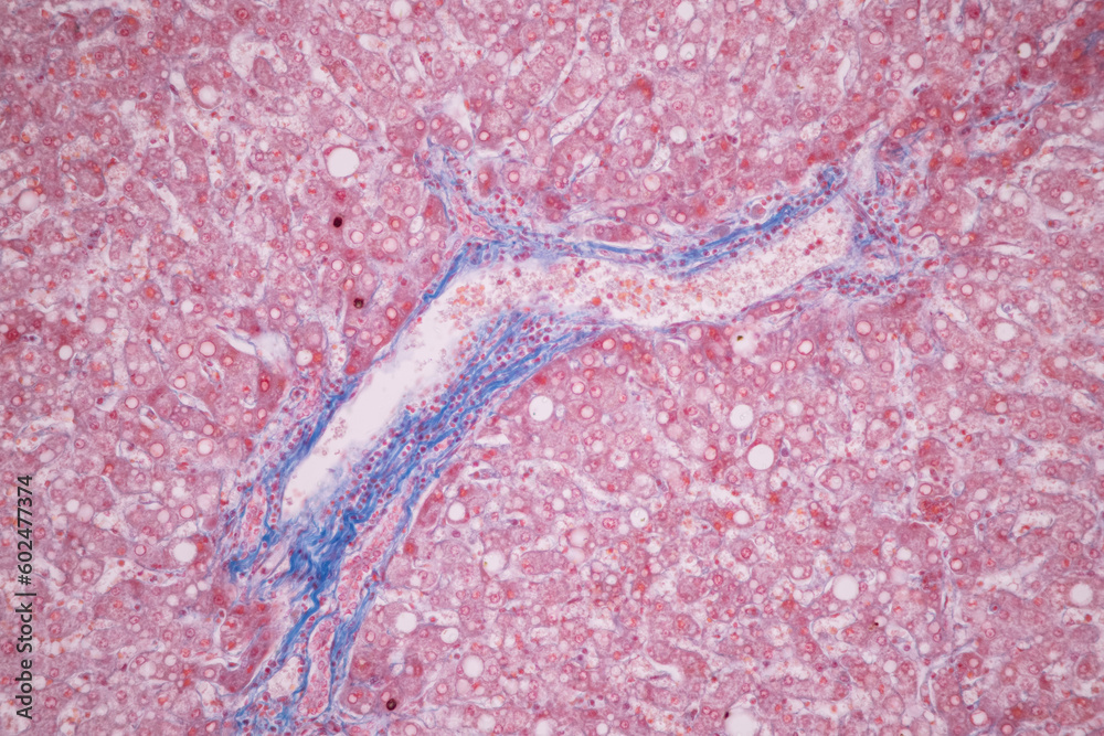 Foto de Histological Pancreas human, Liver human, Vermiform appendix ...