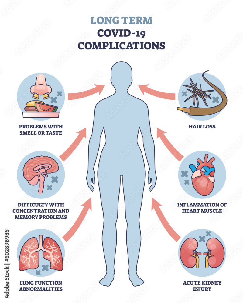 Long term COVID 19 complications with medical symptoms outline diagram. Labeled educational ...