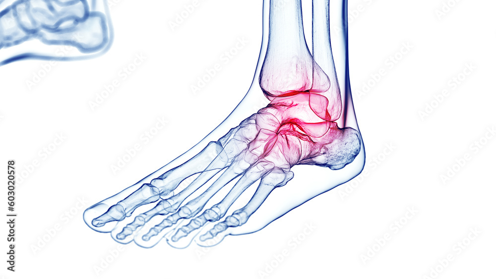 3D Rendered Medical Illustration of foot pain. Stock Illustration ...