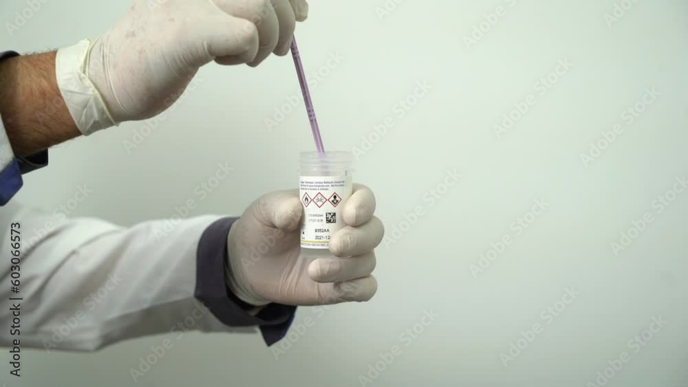 Toma de muestra para la detección del Virus del Papiloma Humano. Stock ...