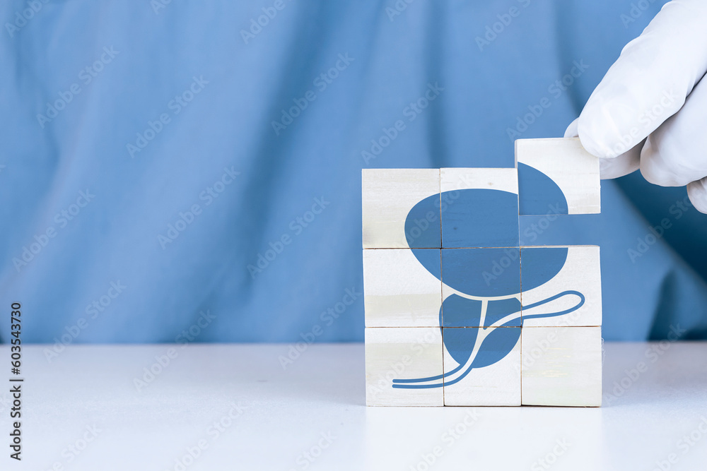 Bladder and prostate, HTA. Prostate cancer, bladder cancer, men's ...