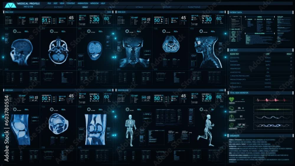 Medical Profile of Patient Showing Knee, Head and Neck MRI Scan, 3D ...