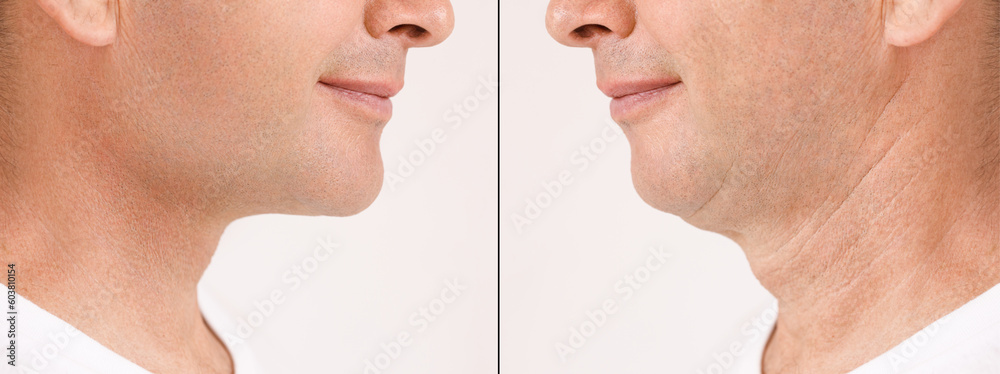 A close portrait of an aged man before and after the facial ...