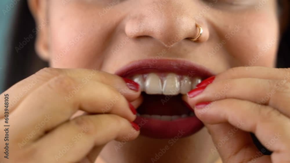 Young Asian Indian woman holding removable invisible aligner, also ...