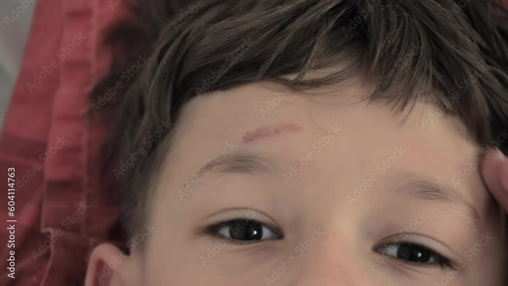 Portrait of a sad boy with a scratch and bump on his forehead. vídeo do ...
