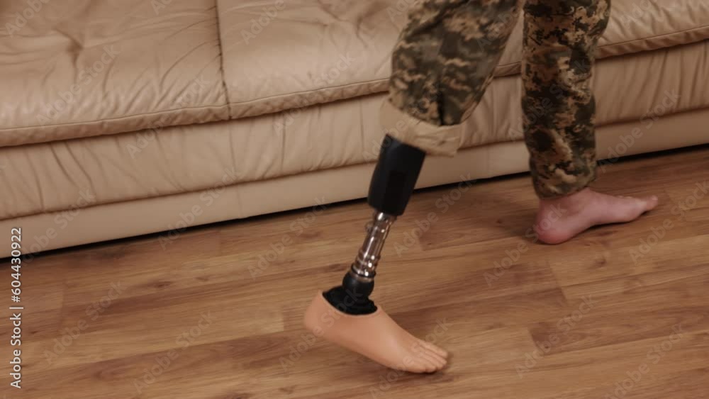 Trauma recovery, War veteran, Combat amputation. Man with an amputated limb, military officer ...