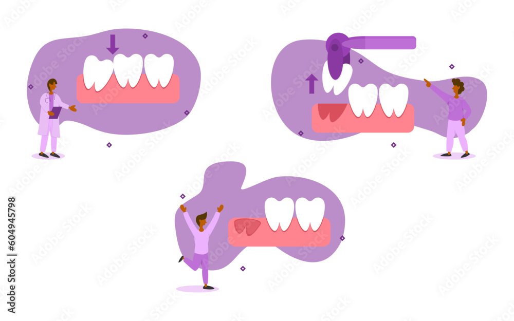 dental care illustration set. characters have wisdom teeth that collide ...