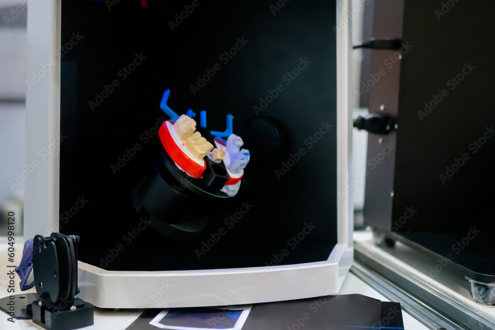 Automatic 3D dental scanner for dental gypsum model scanning and ...