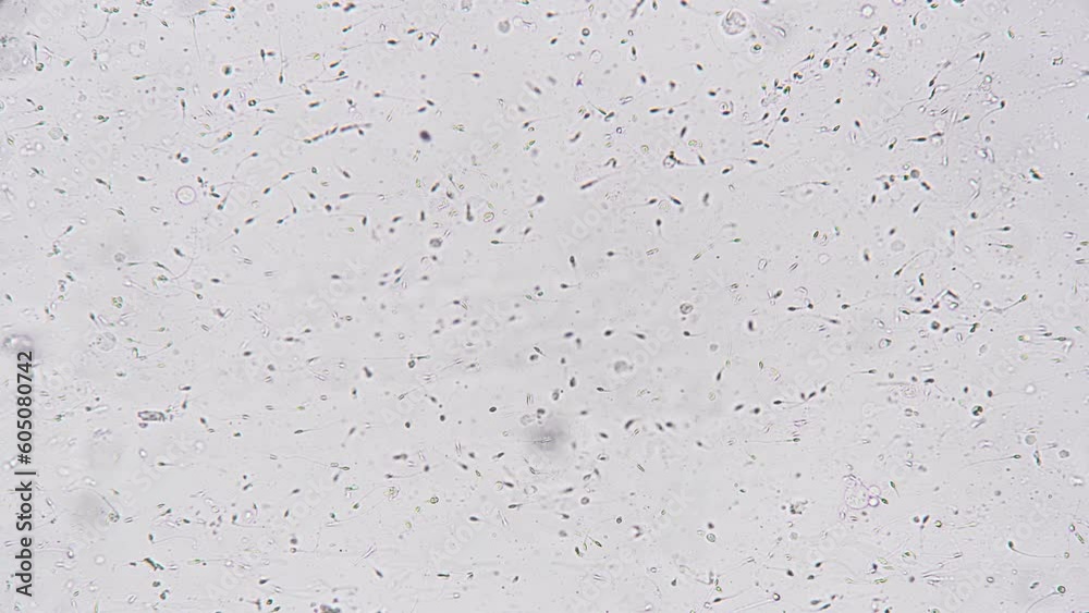 Video Stock Examination biological material of semen under microscope ...