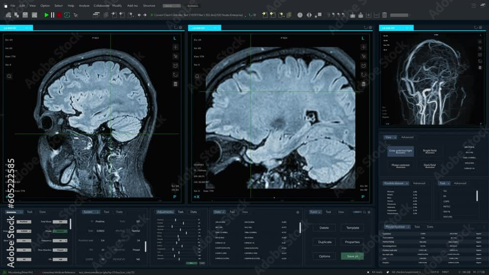 Medical Software Interface Showing Real-Time Process of Magnetic ...
