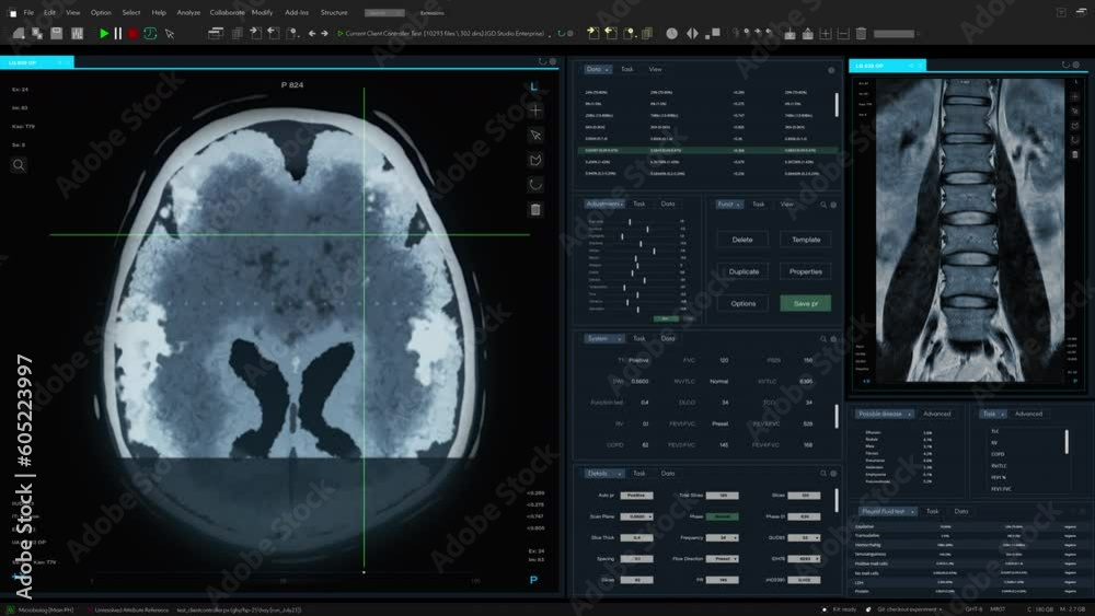 Magnetic Resonance Imaging Brain and Spinal Cord Scan Mock-up with ...