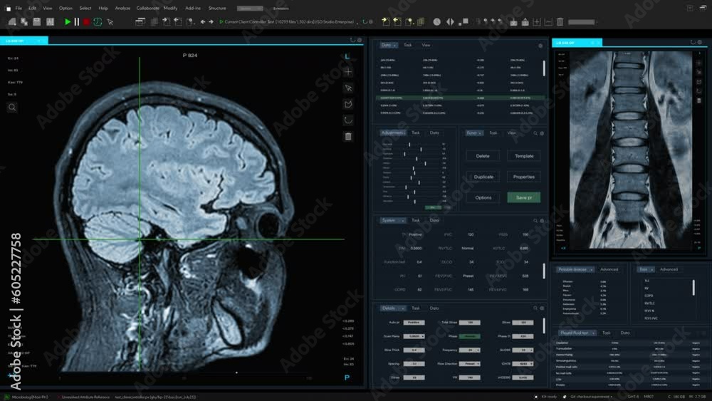 Magnetic Resonance Imaging Brain and Spinal Cord Scan Mock-up with ...