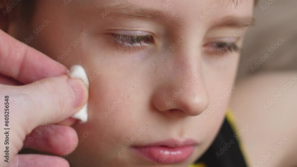 Vidéo Stock portrait of a courageous patient European schoolboy boy who ...