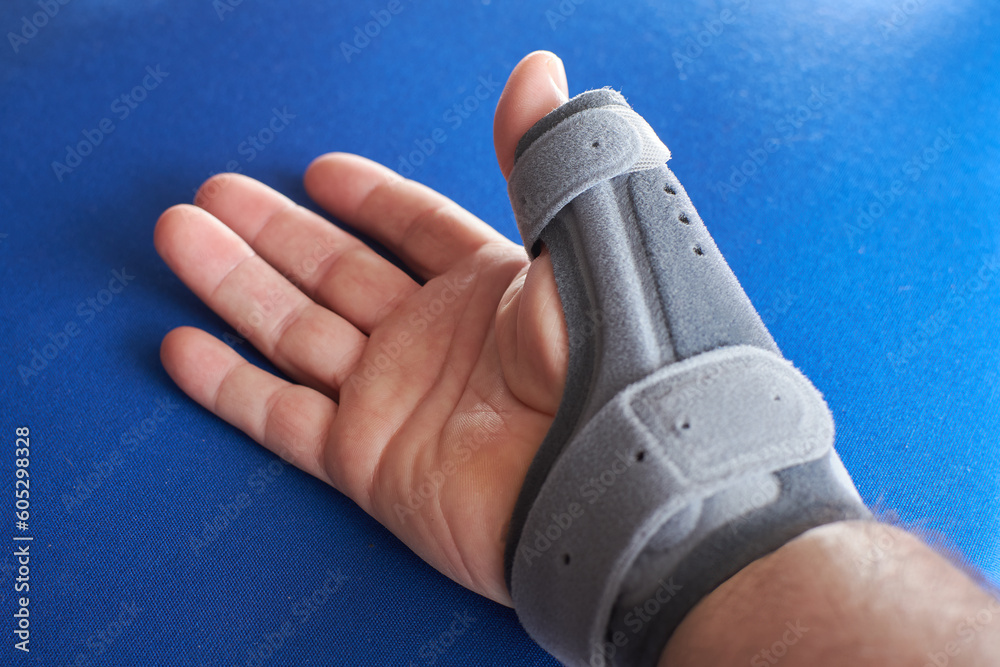 Hand with de quervain's tenosynovitis. Tendonitis. Wrist thumb ...