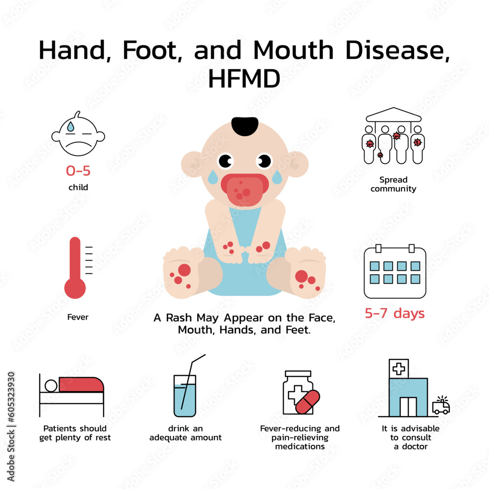 Hand, foot and mouth disease (HFMD) with symptoms prevention and ...