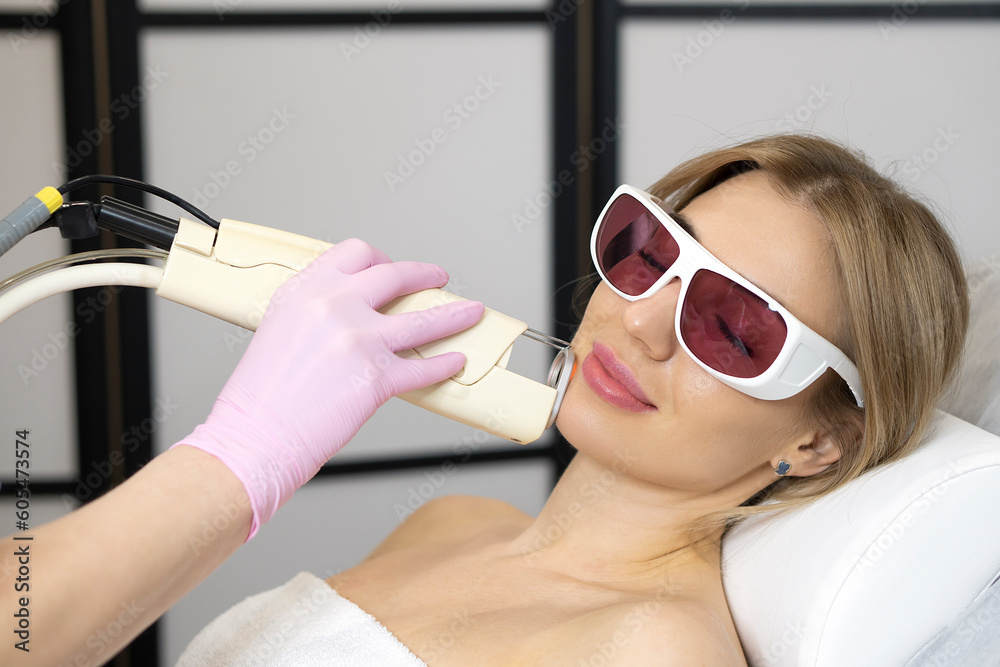 Laser epilation of the face on the device Alexandrite. innovations in ...