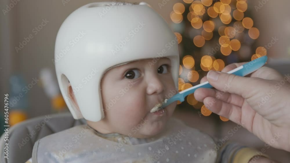 8 Month Old Baby Wearing Therapy Helmet In High Chair Eating and Looks ...