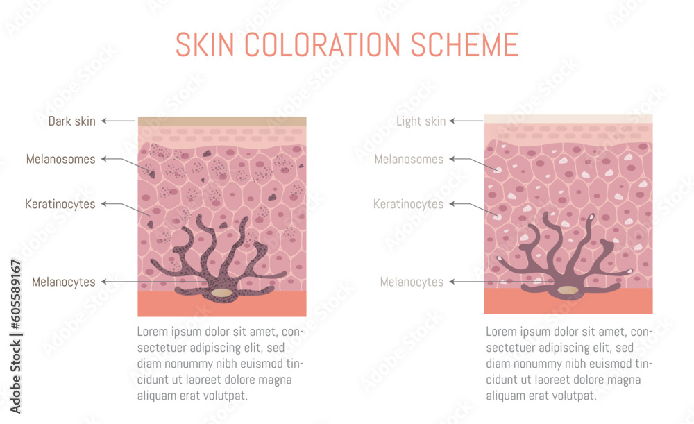 Diagram of skin coloration, for light and dark skin. Diagram of a ...